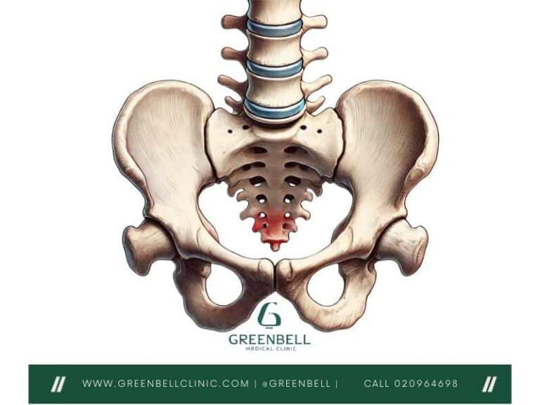 Understanding Coccygeal Vertebrae: Basic Anatomy Guide - Greenbell Clinic